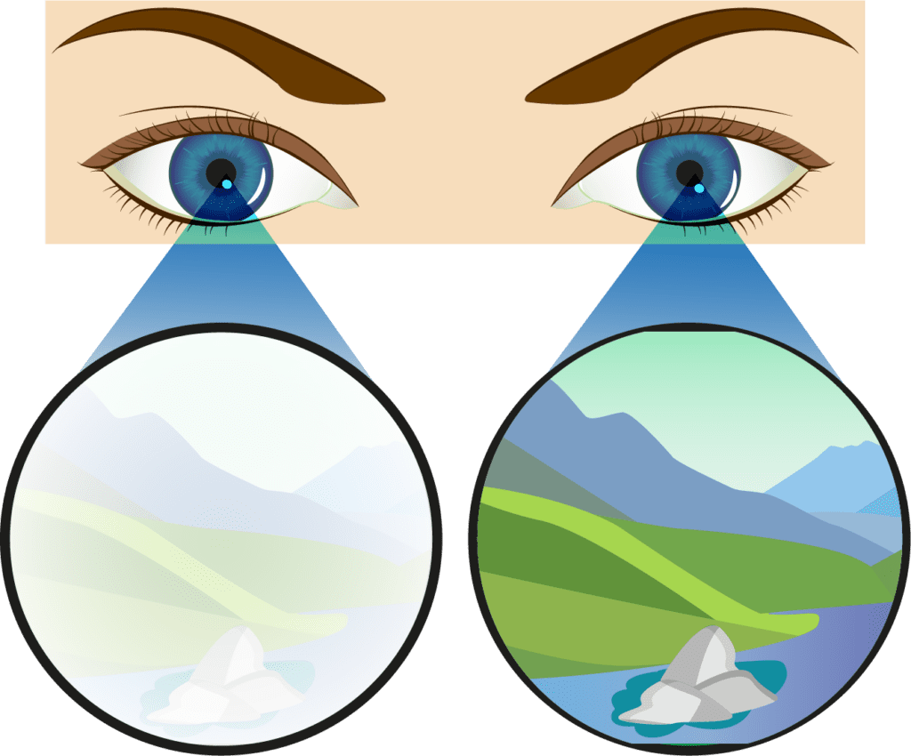 Amblyopia Treatment | TKHY Eye Care Centre | Rapid City, SD