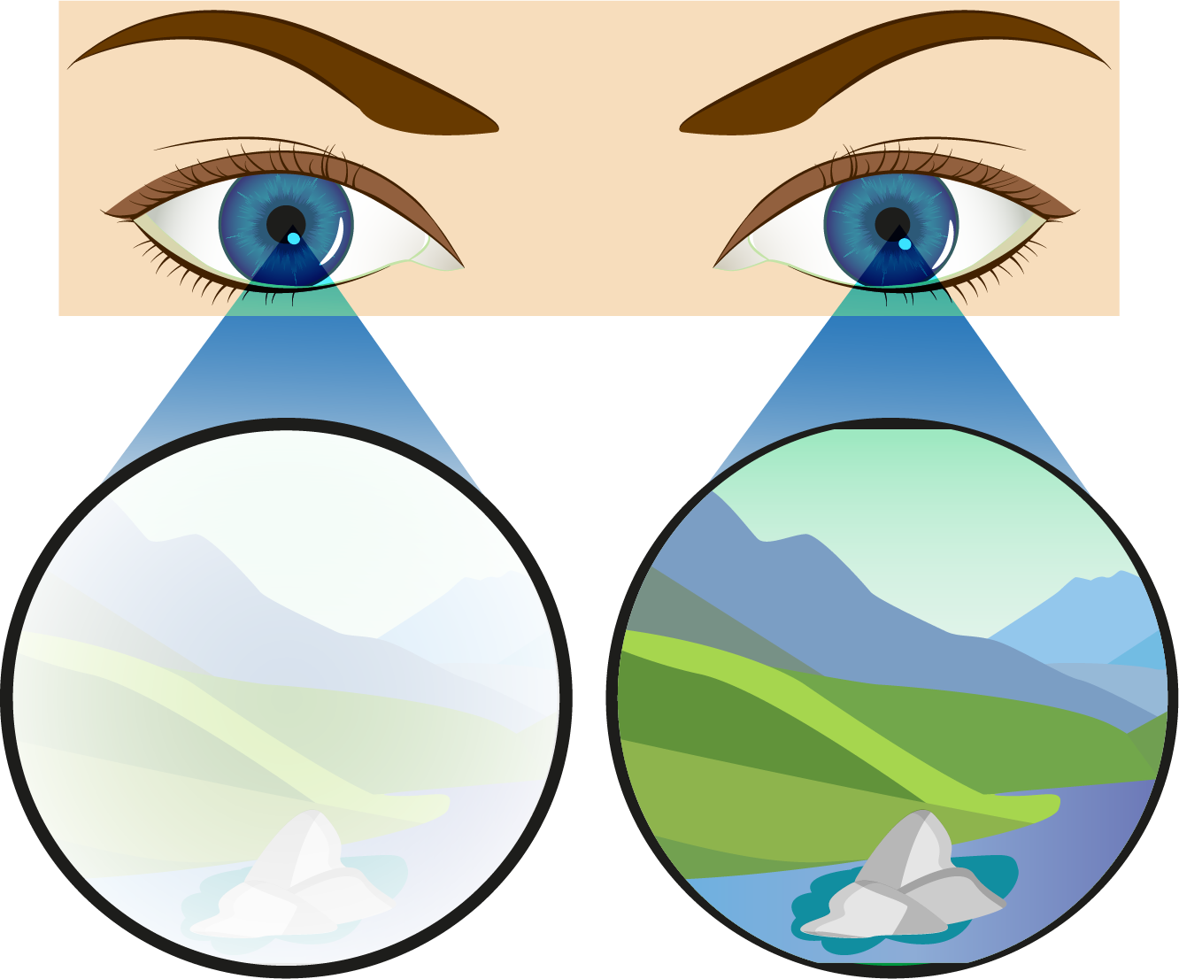 Amblyopia Treatment | TKHY Eye Care Centre | Rapid City, SD